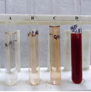 Understanding the Seliwanoff Test: Perfect Way to Distinguish Aldoses ...