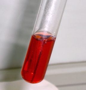 Understanding the Seliwanoff Test: Perfect Way to Distinguish Aldoses ...